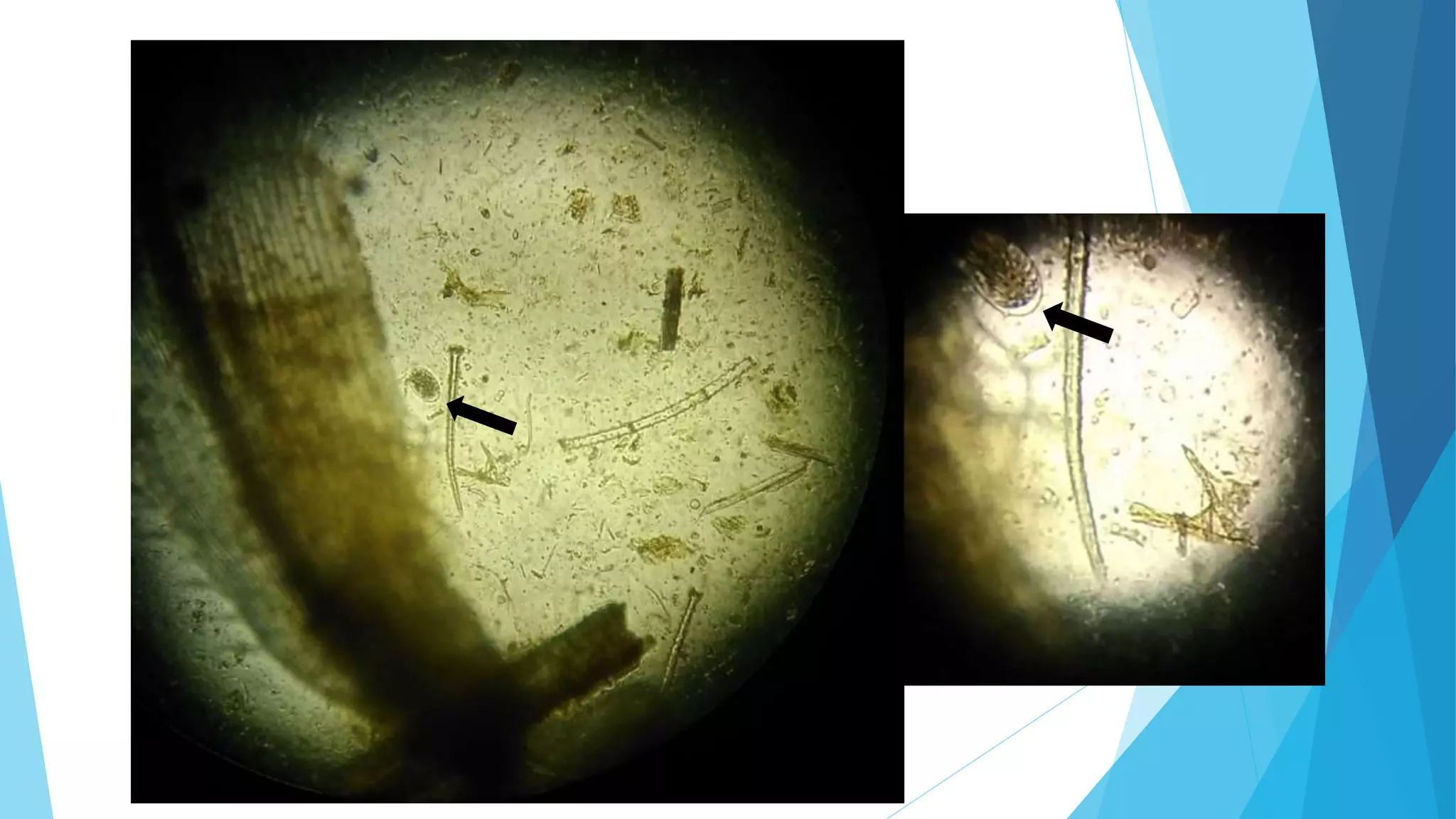 Tenets of faecal examination | PPT