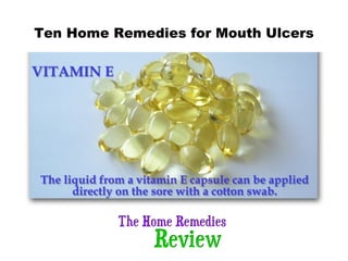Ten Home Remedies for Mouth Ulcers | PPT