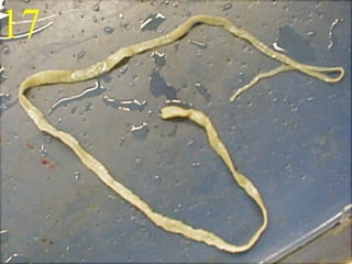 Tenia o solitaria | PPT