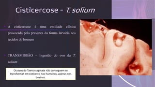 TENÍASE E CISTICERCOSE (1).pdf bem explicado | PDF