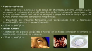 COMPLEJO TENIASIS / CISTICERCOSIS | PPTX