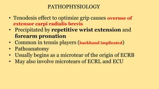 Tennis elbow & Golfer's elbow | PPTX
