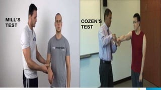 Tennis elbow | EDITED | | PPTX