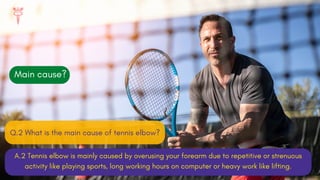 Tennis Elbow | PDF