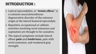 Tennis elbow | Edited | | PPTX
