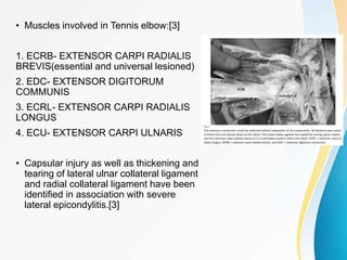 TENNIS ELBOW (Lateral Epicondylitis).pptx | Physical Therapy | Wellness