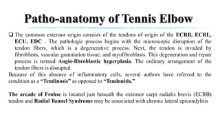 TENNIS ELBOW GOLFERS ELBOW.pptx