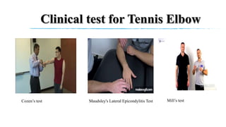 TENNIS ELBOW GOLFERS ELBOW.pptx