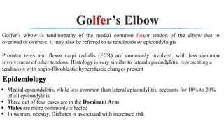 TENNIS ELBOW GOLFERS ELBOW.pptx