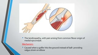 Tennis elbow & Golfers elbow PHYSIOTHERAPY | PPTX
