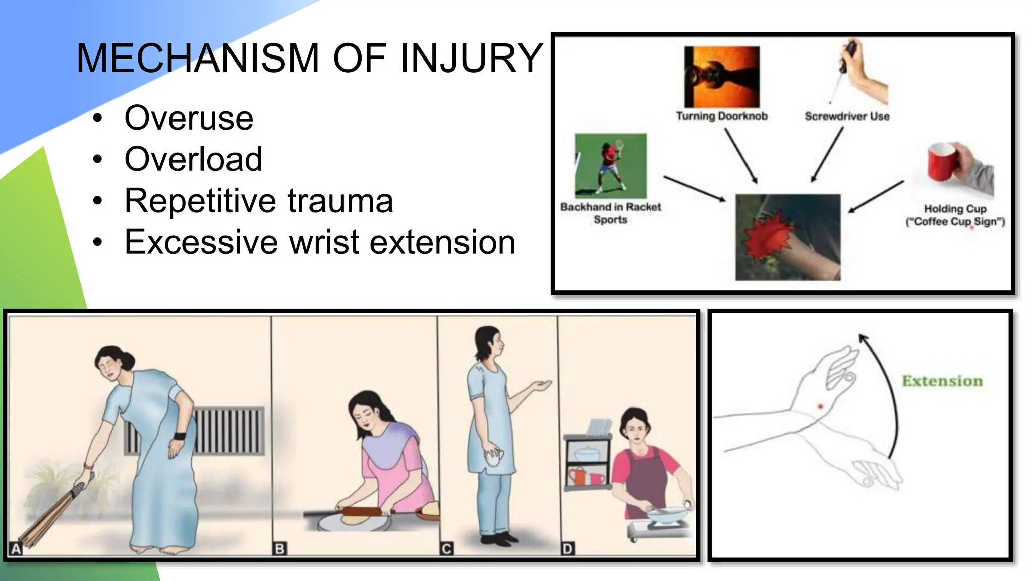 Tennis elbow (Lateral epicondylitis) Orthopaedic | PPTX