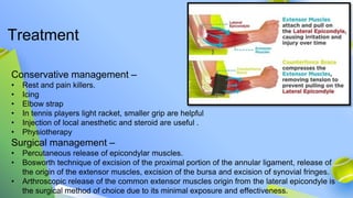 Tennis elbow (Lateral epicondylitis) Orthopaedic | PPTX