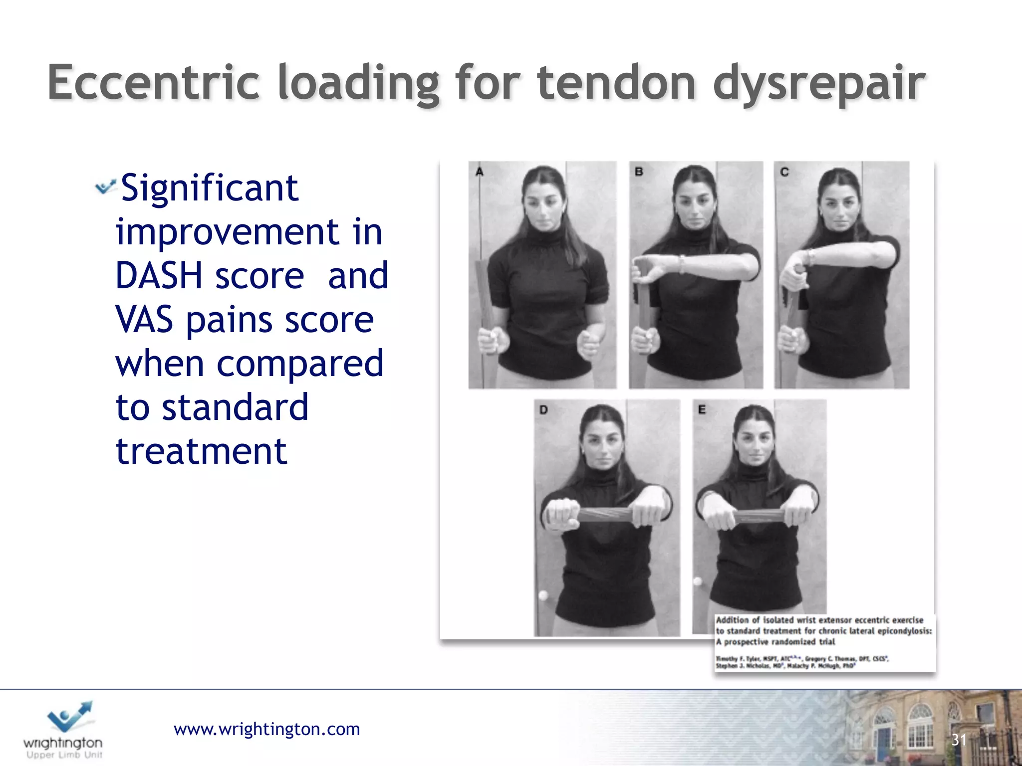 Elbow Tendinopathy | PDF