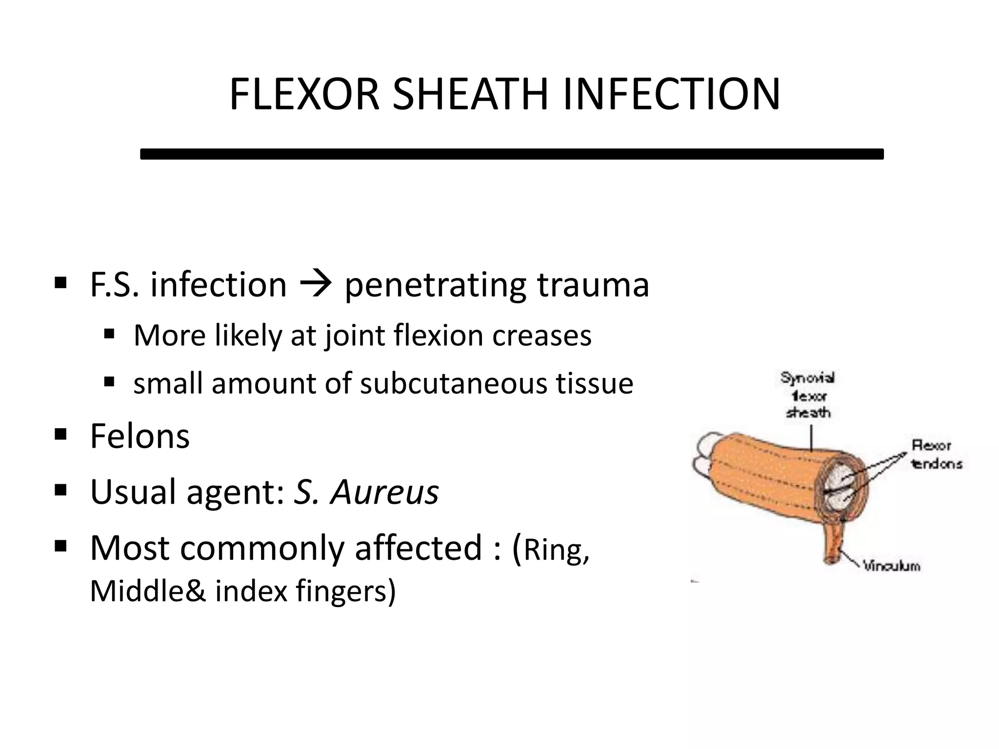 Flexor Tenosynovitis | PPTX | Death, Injury, or Military Conflict ...