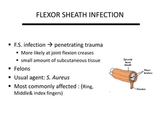 Flexor Tenosynovitis | PPTX