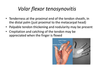 Tenosynovitis | PPT