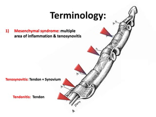 TENOSYNOVITIS.pptx