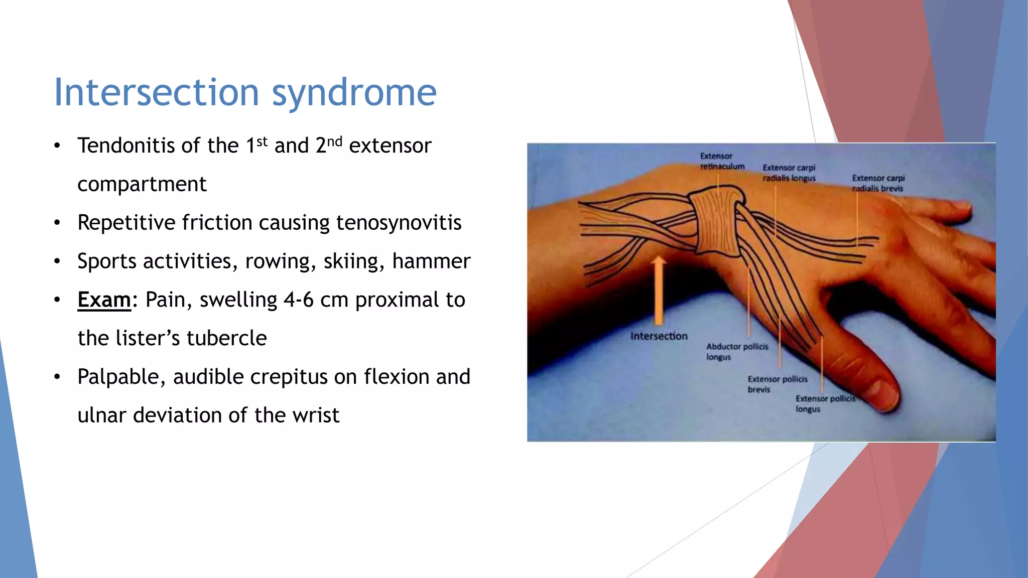 Tenosynovitis disorders of the Upper Extremity | PPTX
