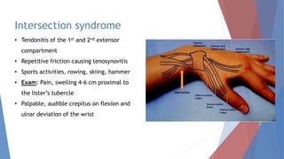 Tenosynovitis disorders of the Upper Extremity | PPTX