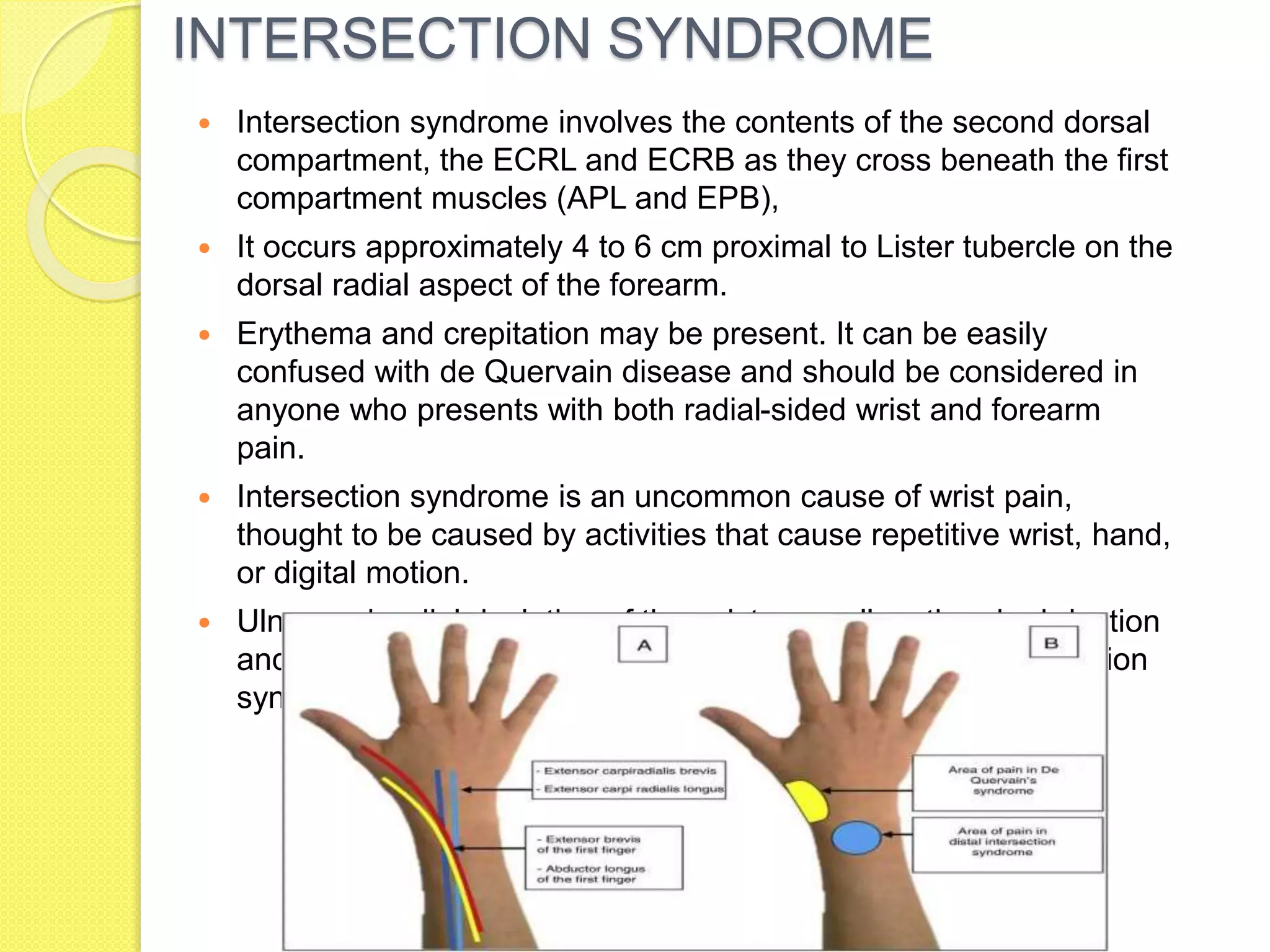 TENOSYNOVITIS DISORDERS OF UPPER EXTREMITY BY MAHEEN.pptx