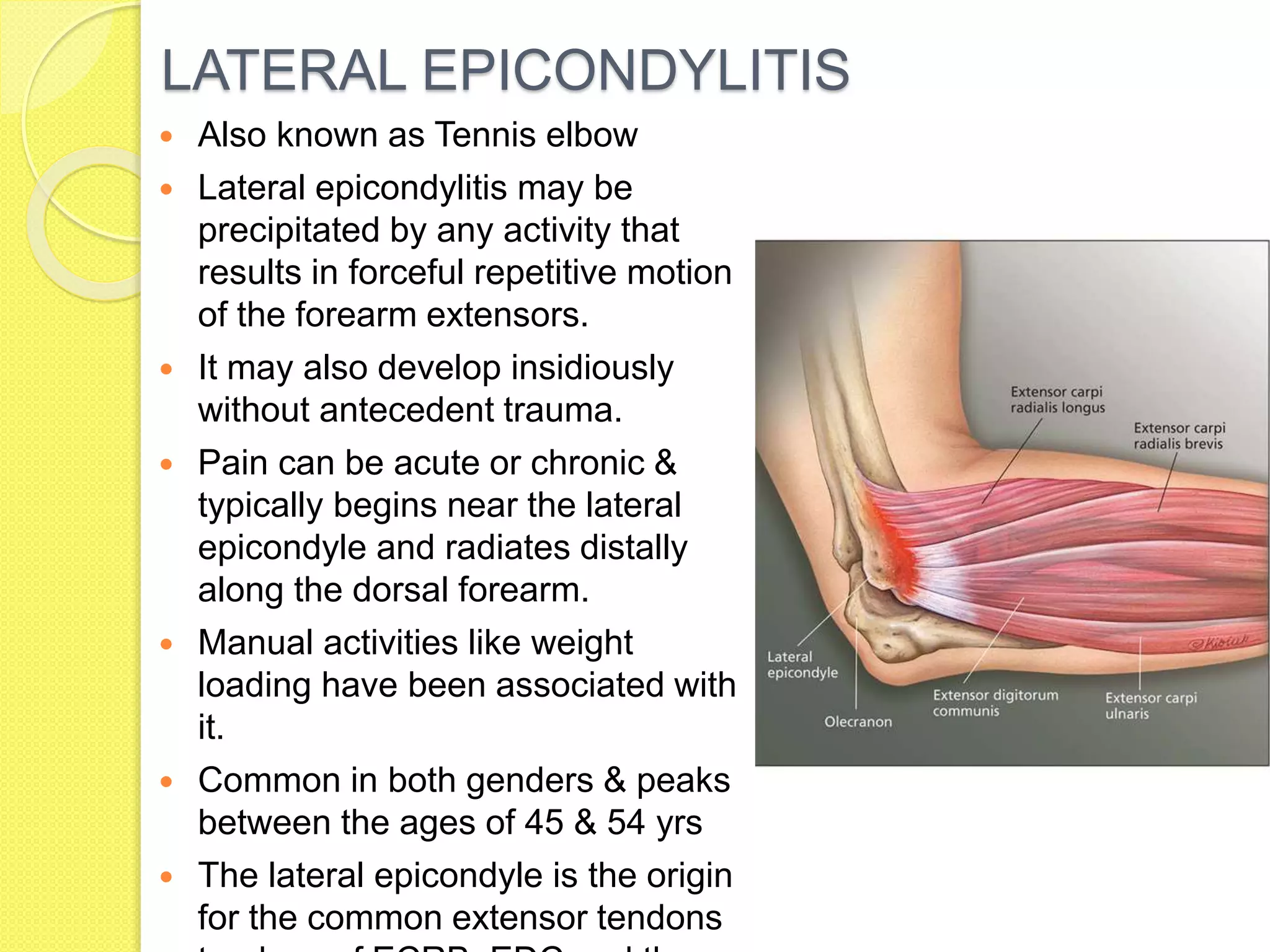 TENOSYNOVITIS DISORDERS OF UPPER EXTREMITY BY MAHEEN.pptx