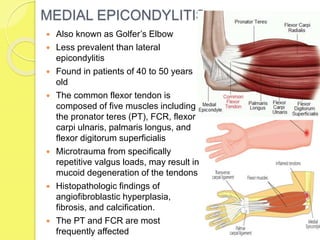 TENOSYNOVITIS DISORDERS OF UPPER EXTREMITY BY MAHEEN.pptx