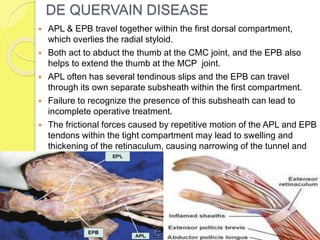 TENOSYNOVITIS DISORDERS OF UPPER EXTREMITY BY MAHEEN.pptx