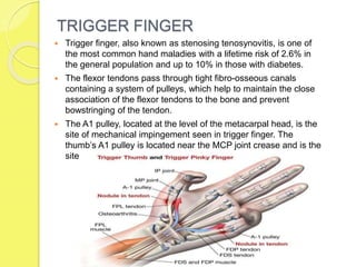 TENOSYNOVITIS DISORDERS OF UPPER EXTREMITY BY MAHEEN.pptx