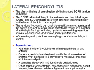 TENOSYNOVITIS DISORDERS OF UPPER EXTREMITY BY MAHEEN.pptx