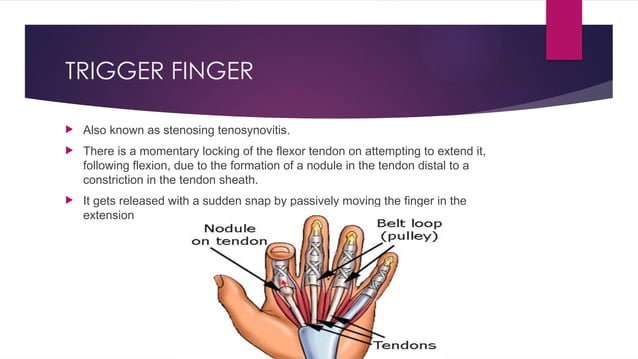 TENOSYNOVITIS EXPLAINED IN DETAILED MANNER | PPTX