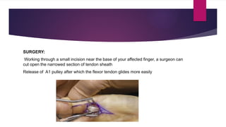 TENOSYNOVITIS EXPLAINED IN DETAILED MANNER | PPTX