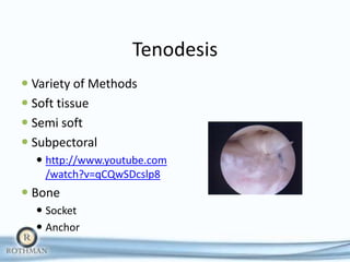 Tenotomy 2013 final | PPTX