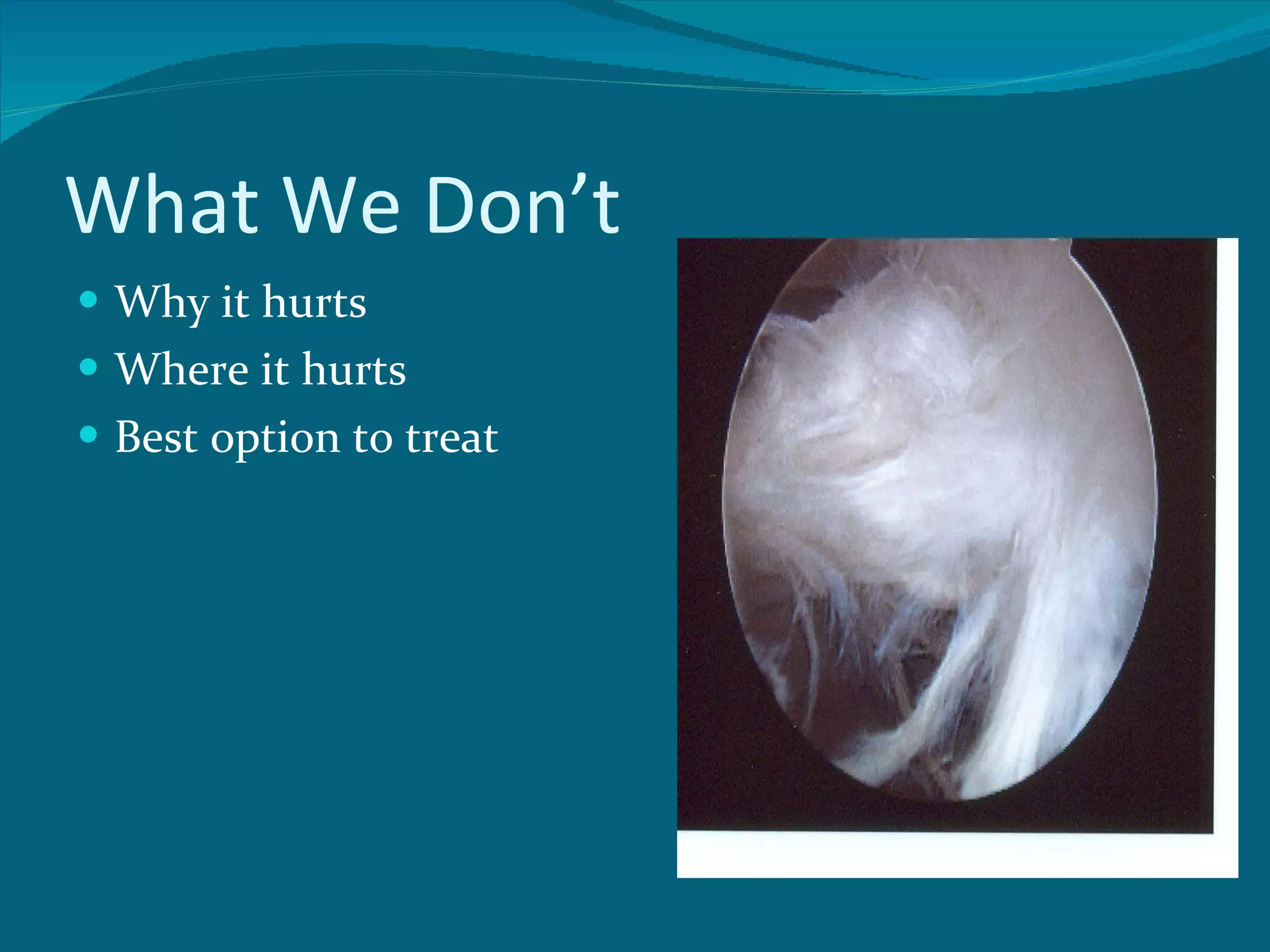 Tenotomy v tenodesis | PPT