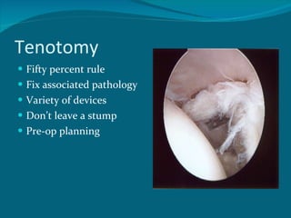 Tenotomy v tenodesis | PPT