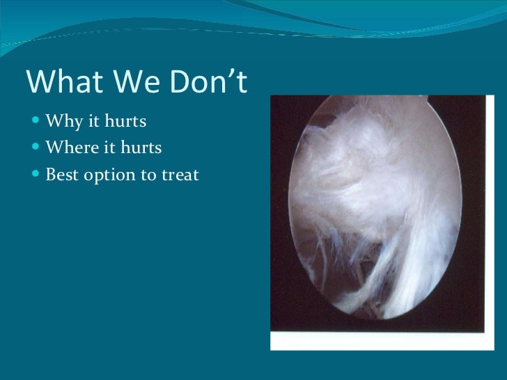 Tenotomy v tenodesis