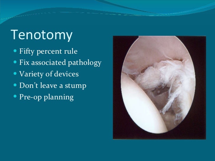 Tenotomy v tenodesis