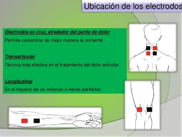 TENS. fisioterapia