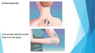 Tens transcutaneous electrical nerve stimulator | PPTX