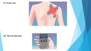 Tens transcutaneous electrical nerve stimulator | PPTX