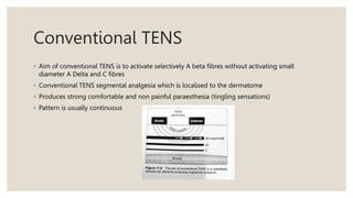 TENS.pptx