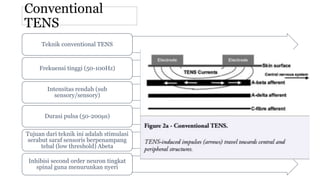 Materi Pembelajaran Fisioterapi Elektroterapi TENS | PPTX