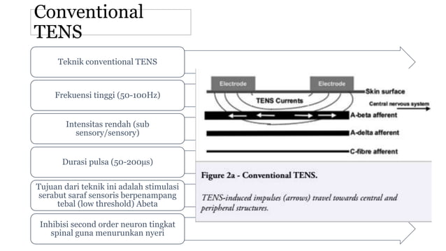 Materi Pembelajaran Fisioterapi Elektroterapi TENS | PPTX