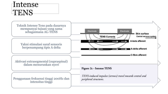 Materi Pembelajaran Fisioterapi Elektroterapi TENS | PPTX