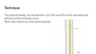Titanium elastic nail system -all about.pptx