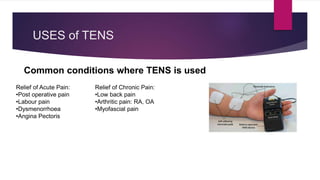 TENS by AK | PPTX