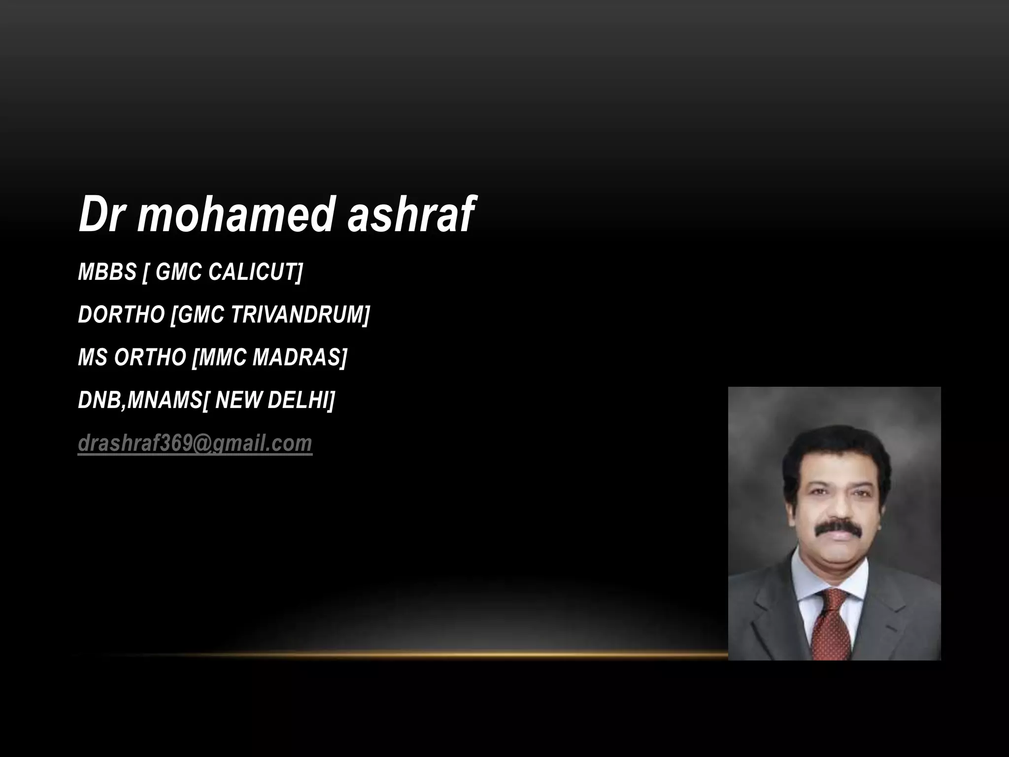 Tension band wiring and plating of fractures- dr mohamed ashraf.govt TD medical college,alleppey ...