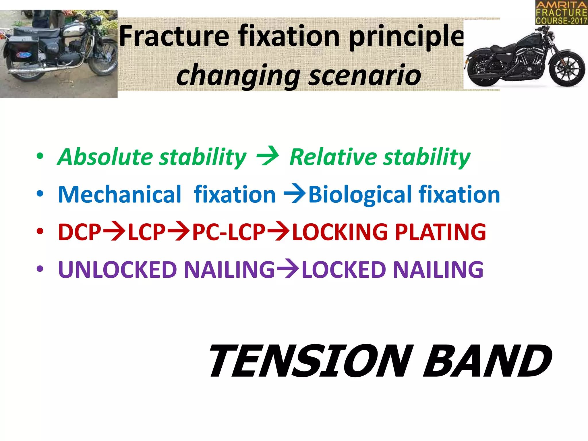 Tension band wiring and plating of fractures- dr mohamed ashraf.govt TD ...