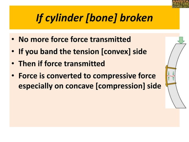 Tension band wiring and plating of fractures- dr mohamed ashraf.govt TD ...