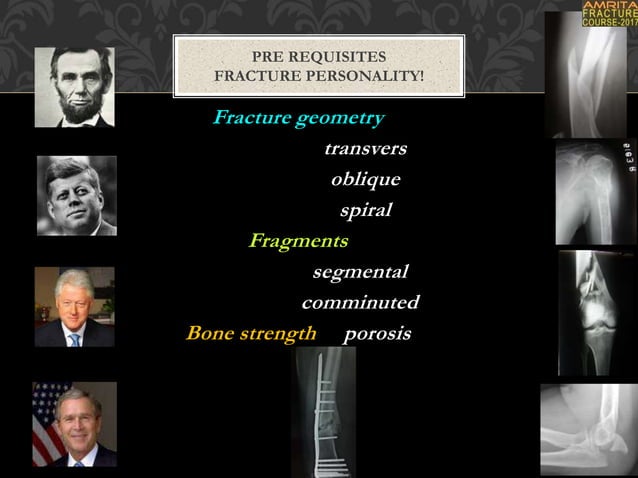 Tension band wiring and plating of fractures- dr mohamed ashraf.govt TD ...