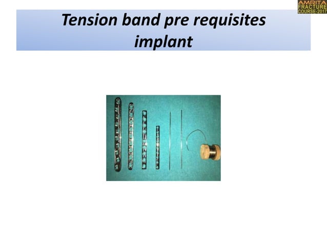 Tension band wiring and plating of fractures- dr mohamed ashraf.govt TD ...